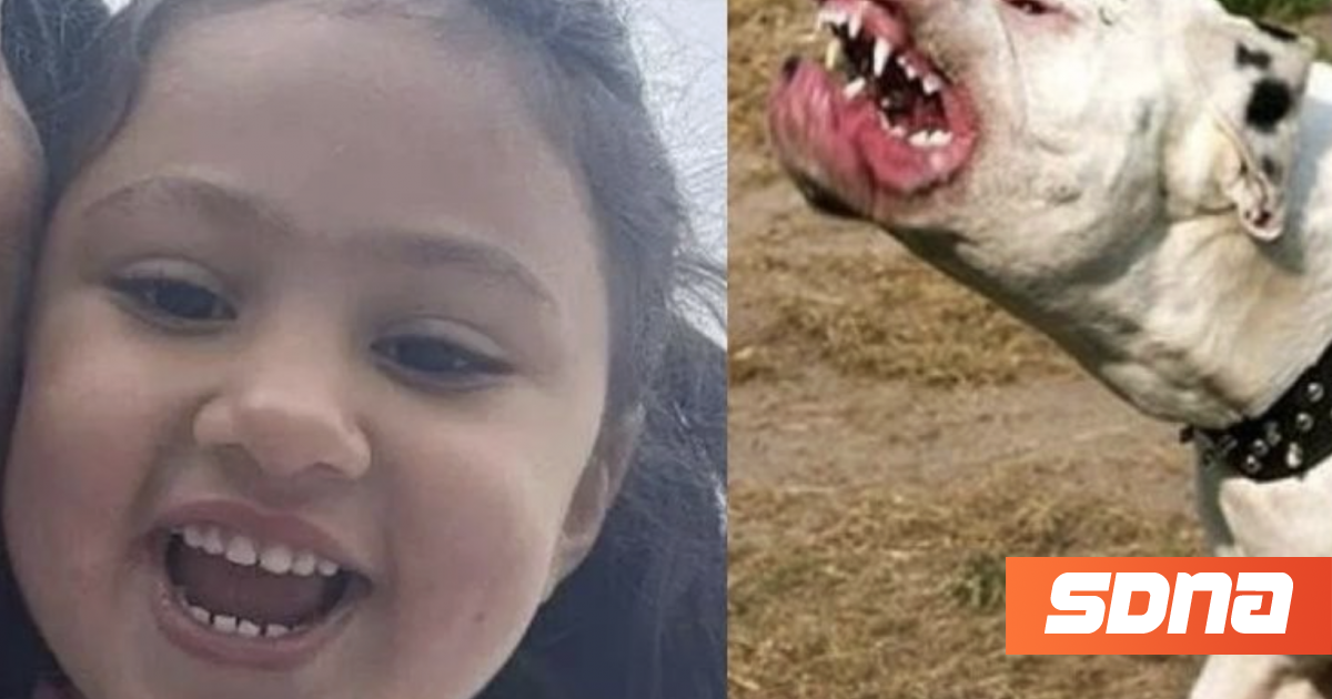 Παρ'ολίγον τραγωδία: Pit bull επιτέθηκε σε 4χρονη - Της «έσκισε» το πρόσωπο - Σκληρές εικόνες | SDNA